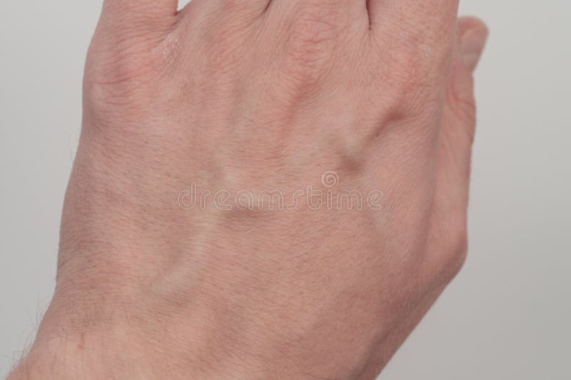 Closeup of Man Hand Skin with Visible Veins Stock Image - Image of ...