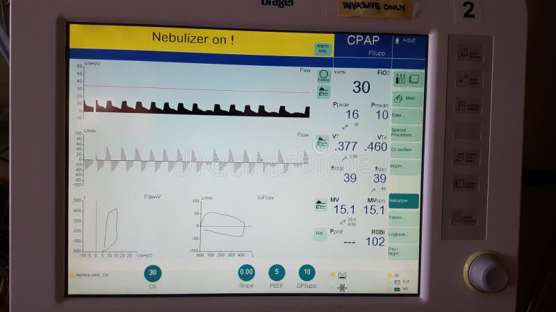 Closeup of a Mechanical Ventilator,s Control Panel Stock Photo - Image ...