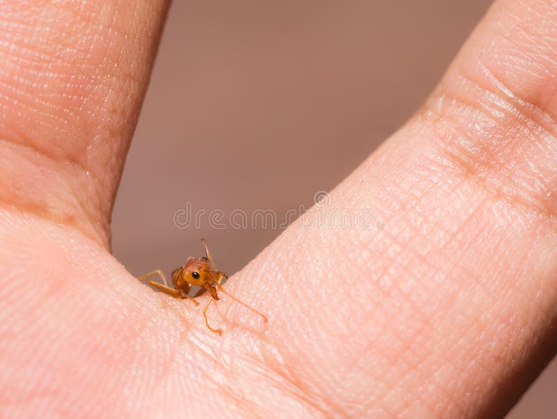 Closeup Red Ant Bite Man Hand Stock Photo - Image of bite, white: 91526616