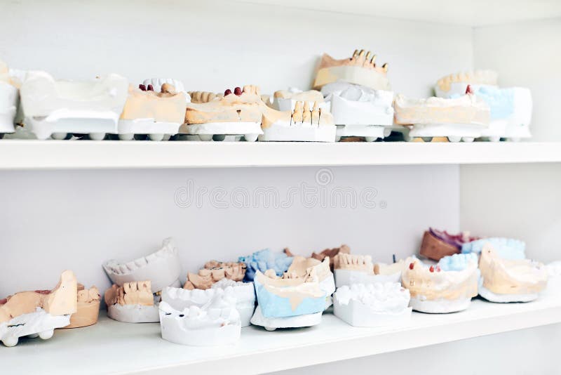 A Closeup of a Shelf with the Casts of Human Teeth and Dentures Stock ...