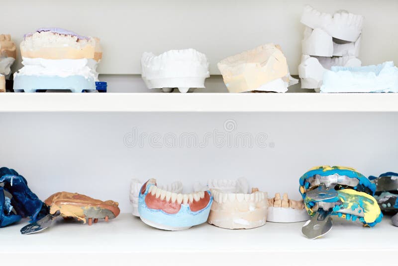 A Closeup of a Shelf with the Casts of Human Teeth and Dentures Stock ...