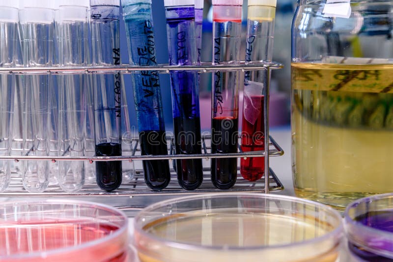 Closeup Shot of Laboratory Test Tubes with Different Substances for ...