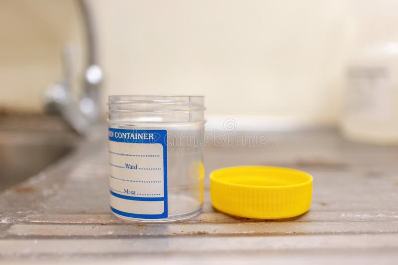 A Specimen Container for Lab Test Stock Image - Image of medical ...