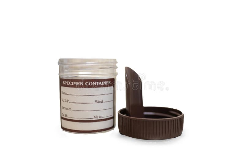 A Specimen Container for Lab Test Stock Image - Image of 2019ncov ...