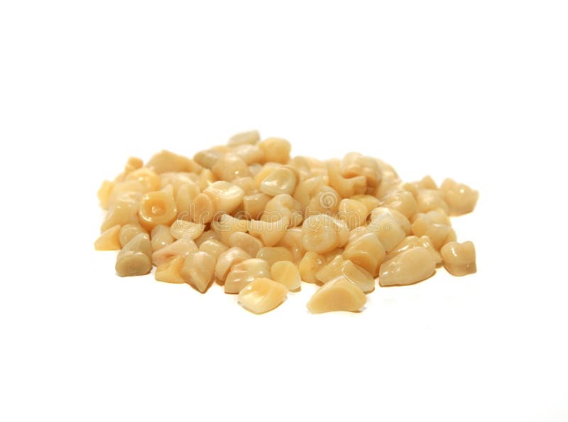 Shot of X Ray of Teeth Isolated on White Background Stock Photo - Image ...