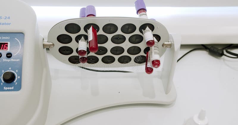 Closeup on Vertical Mini Rotator with Blood Samples Tubes at Clinic ...