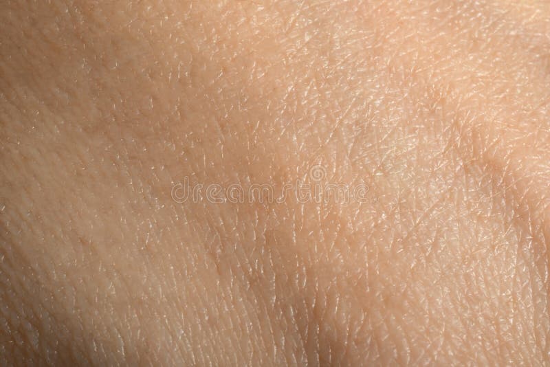 Closeup View of Dry Human Skin As Background Stock Image - Image of ...