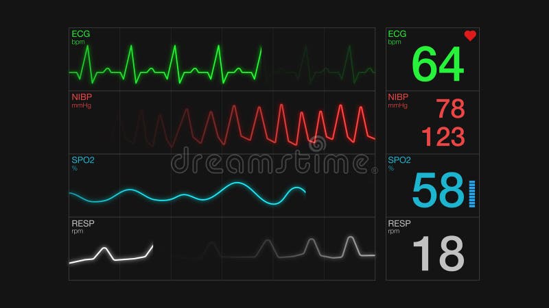 Ecg ekg screen stock illustration. Illustration of cardiology - 169101203
