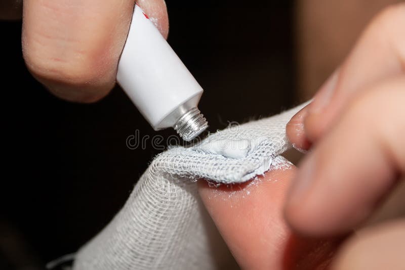 Closeup View of Hands Squeezing Thermal Paste from a White Tube Onto a ...