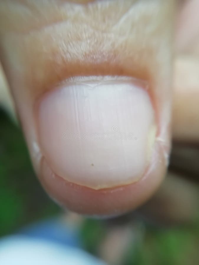 Closeup of a Human Finger Nail Stock Photo - Image of sign, hand: 198390754