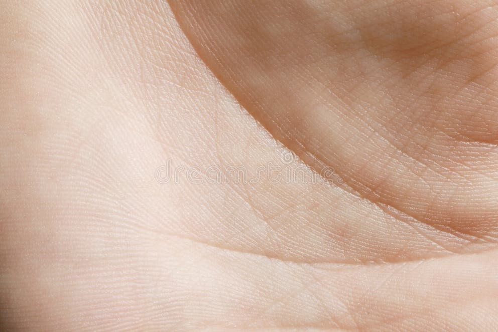 Closeup View of Human Hand with Dry Skin Stock Photo - Image of ...