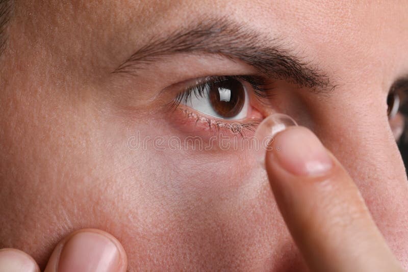 Closeup View of Man Putting Contact Lens in His Eye Stock Image - Image ...
