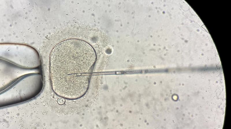 View through Microscope at in Vitro Fertilization Process Stock Video ...
