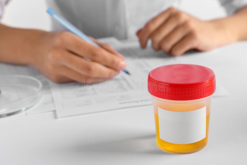 Closeup View of Nurse Writing Urine Analysis Results at Table, Focus on ...