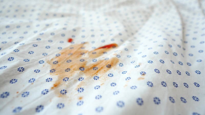 A Stained Bed Sheet with Visible Spills and Marks, Showing Issues with ...
