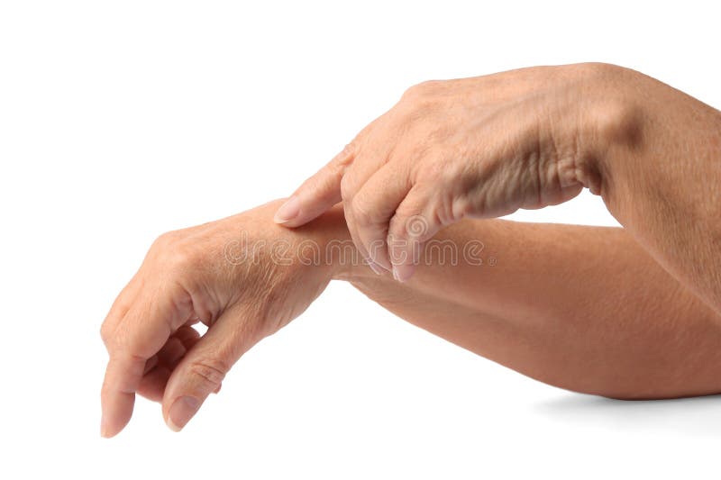 Closeup View of Woman S Hands with Aging Skin Stock Image - Image of ...