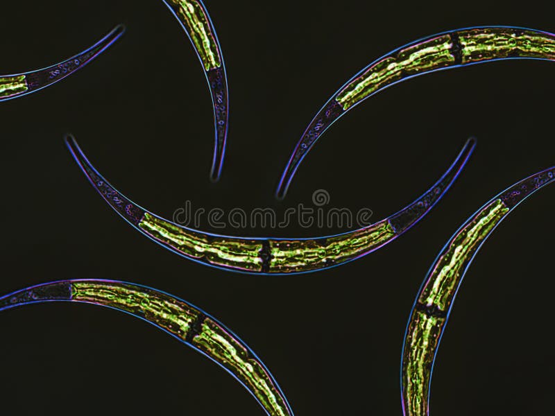 Closterium Sp. Charophyta Algae Under Microscopic View X40, Green Algae ...