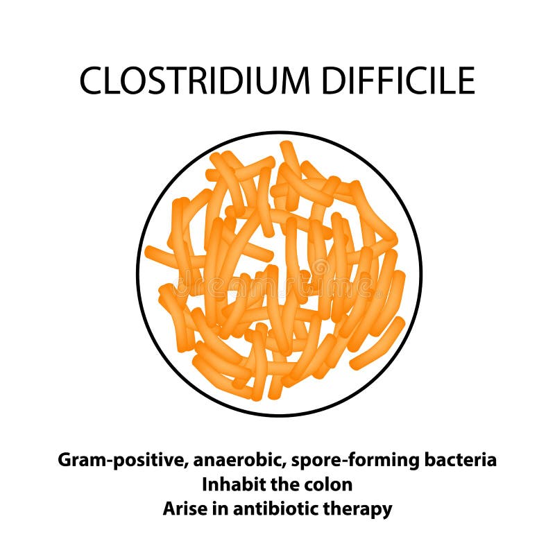 Clostridium Difficile. Pathogenic Flora. the Bacterium Causes ...