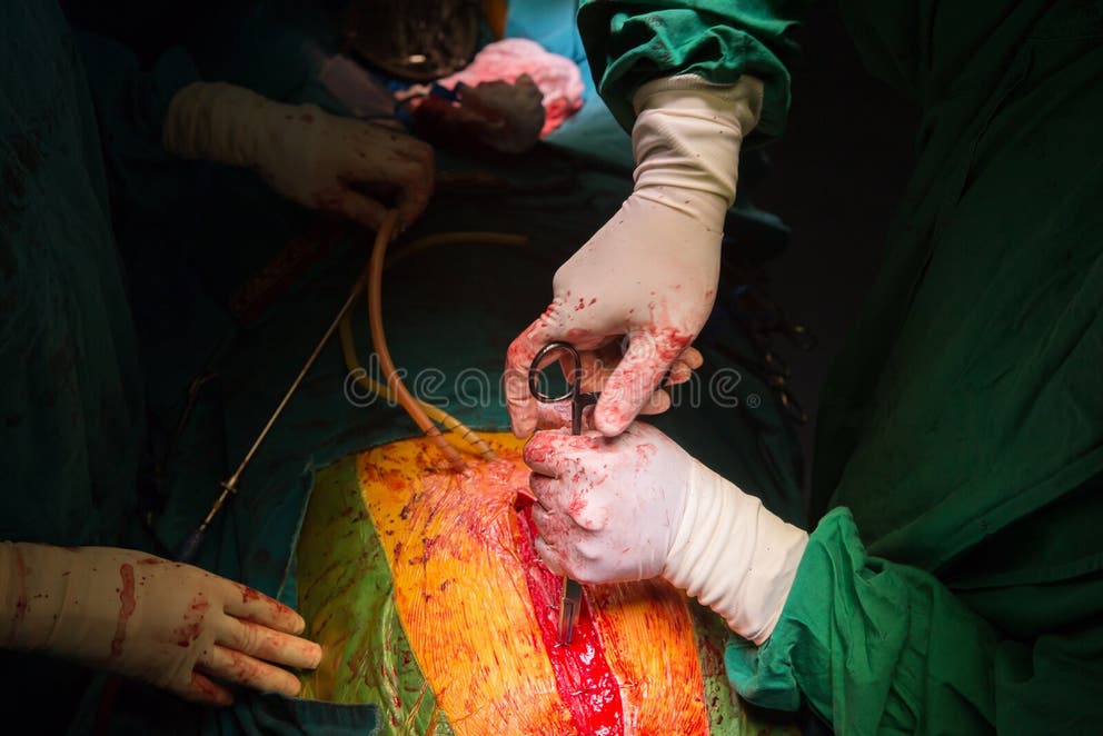 Closure sternum stock photo. Image of open, occupation - 52399808