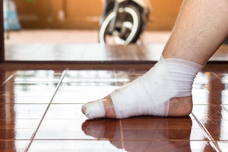 Cloth Wound Closure on Blood Blisters Reflection and Side Effect from ...