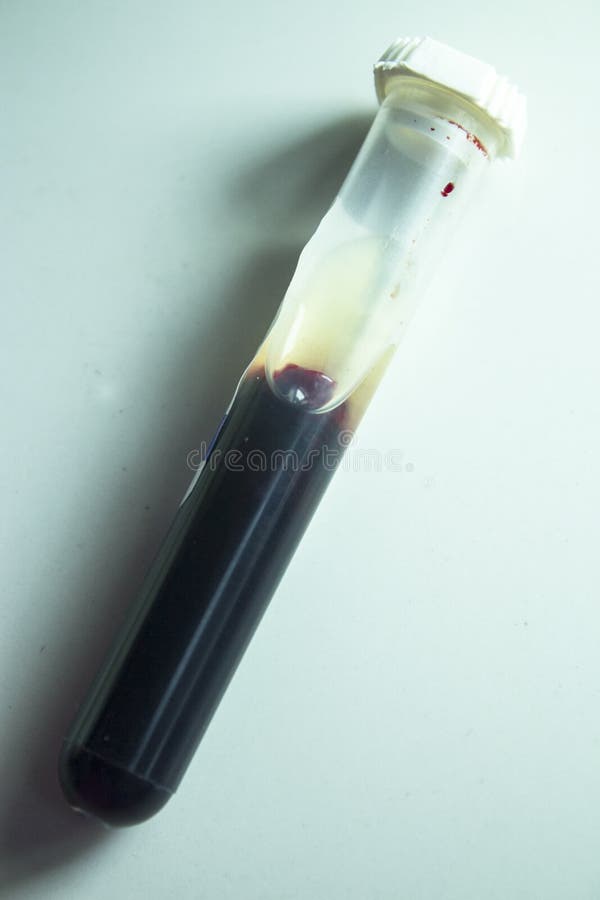 Coagulated Blood Photos - Free & Royalty-Free Stock Photos from Dreamstime