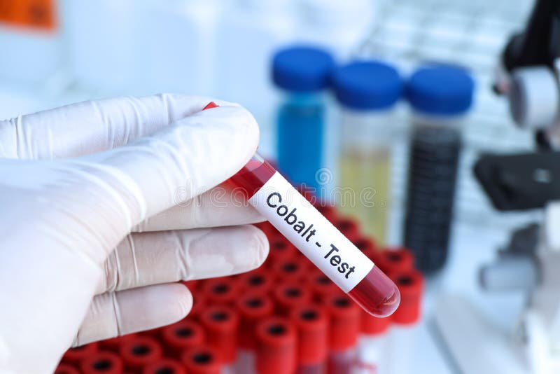 Cobalt Test To Look for Abnormalities from Blood Stock Image - Image of ...