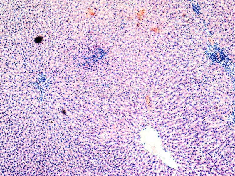 Koccidiosis Coccidia in Lever Light Micrograph Arkivfoto - Bild av ...