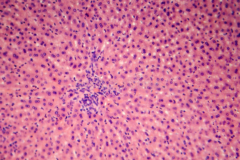 Coccidiosis Coccidia Liver Stock Photos - Free & Royalty-Free Stock ...