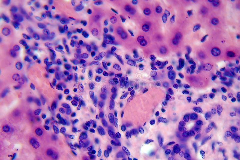 Coccidiosis, Coccidia in Liver, Light Micrograph Stock Image - Image of ...