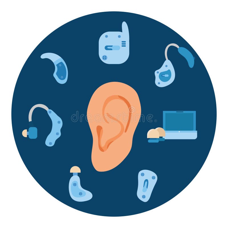 Cochlear Implant Collection Stock Vector - Illustration of implant ...