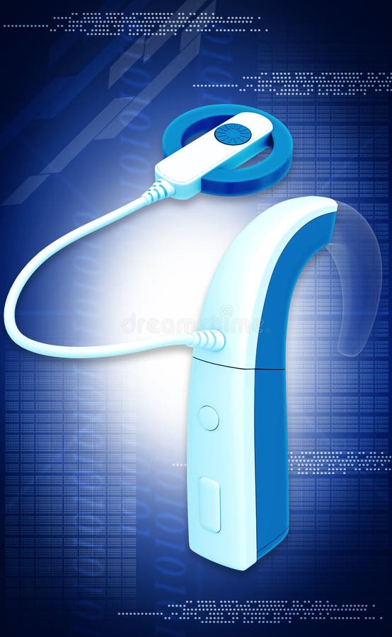 Cochlear Implant Ear Stock Illustrations – 49 Cochlear Implant Ear ...