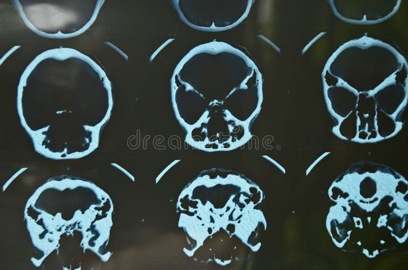 Xray Shell Stock Photos - Free & Royalty-Free Stock Photos from Dreamstime