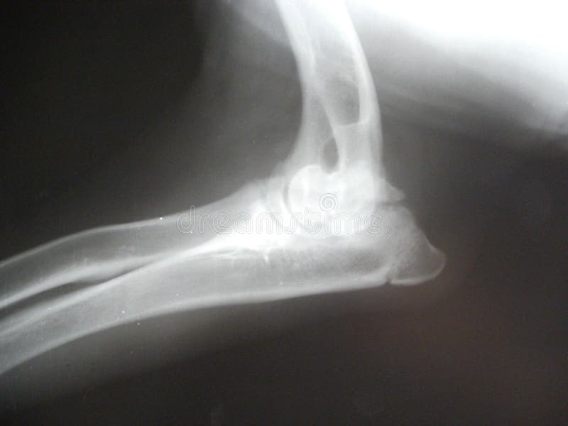 Codo - Processus Ununited Ancóneo, Perro Foto de archivo - Imagen de ...