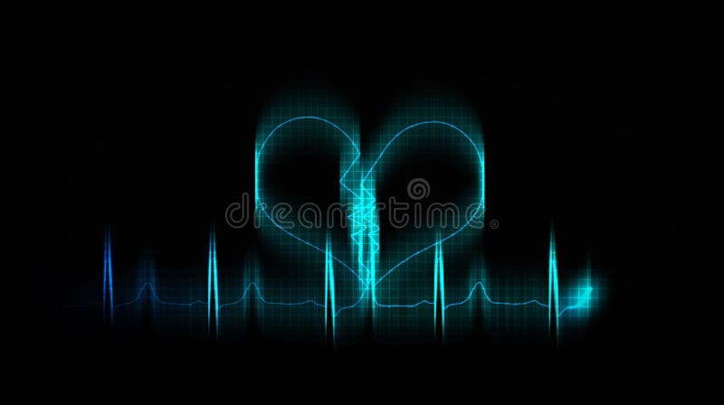 Coeur Attask Cardiogramme D'un Coeur Malade Illustration Stock ...