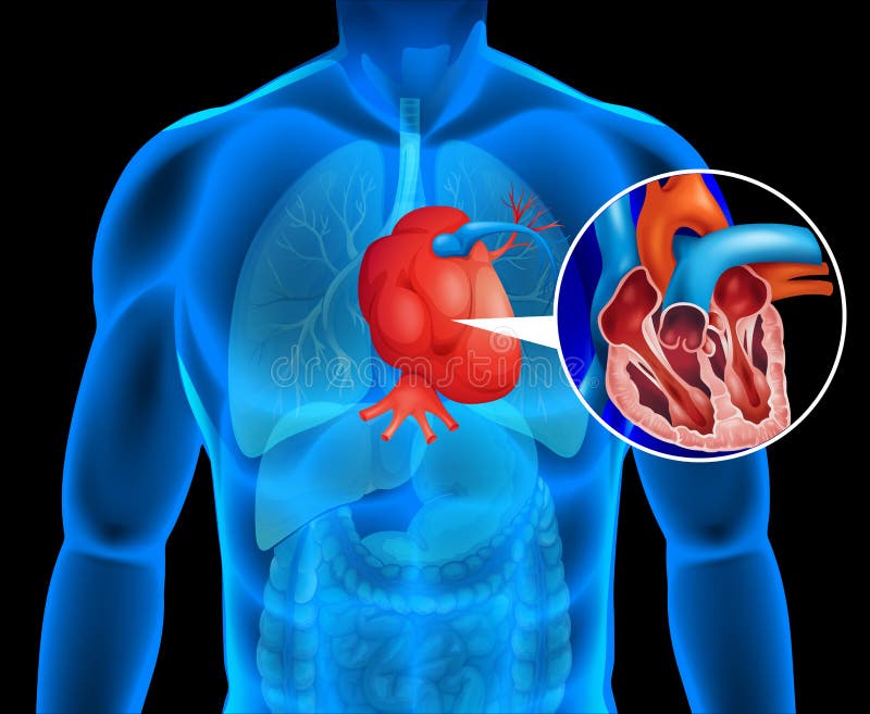 Cancer De Coeur Dans L'humain Illustration de Vecteur - Illustration du ...