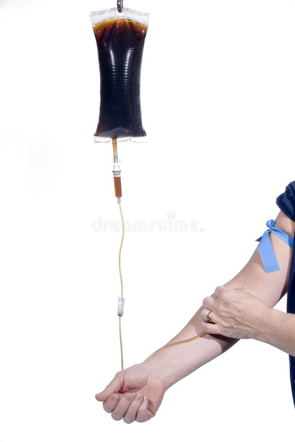 Coffee IV Putting Needle in Arm Stock Image - Image of brown, medical ...