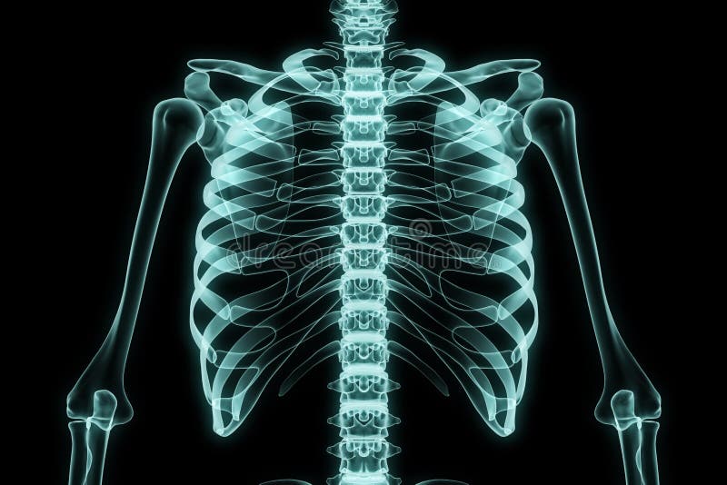 Coffre de rayon X illustration stock. Illustration du radiographie ...