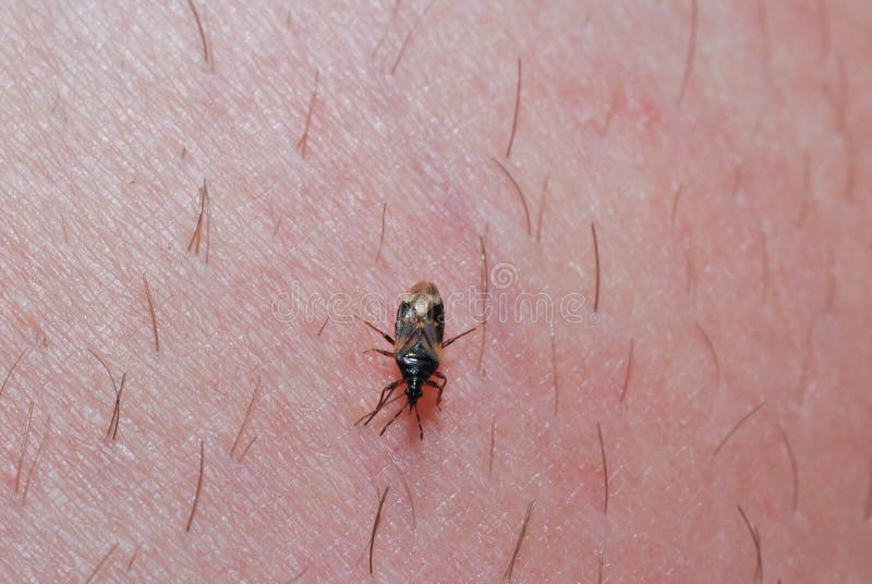 Insecte sur la peau photo stock. Image du saison, insecte - 27408866
