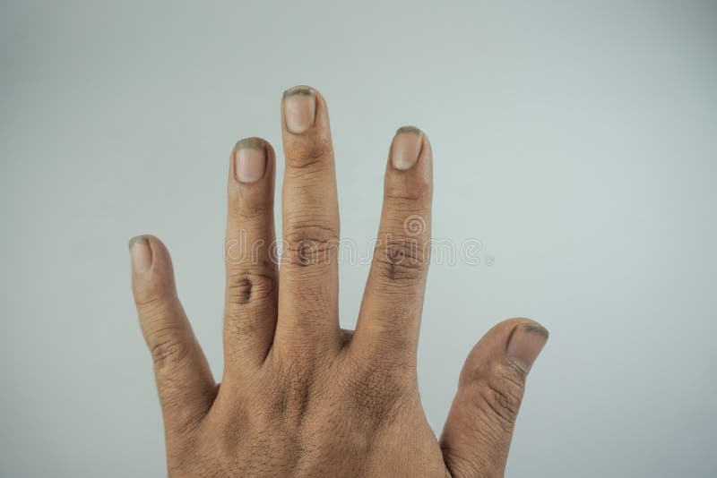 Colar As Mãos Com Unhas Sujas. Unhas Pretas Sujas Imagem de Stock ...