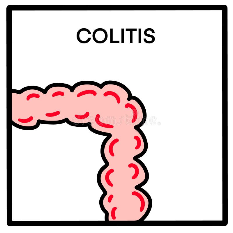 Jaw Pain Symptom of Depression Hand Drawn Vector Illustration in ...