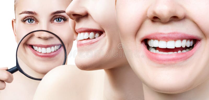 Collage of Perfect Female Teeth Closeup with Text Space. Stock Photo ...