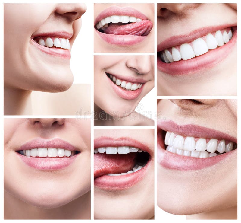 Collage Of Women With Healthy Teeth. Stock Image - Image of freshness ...
