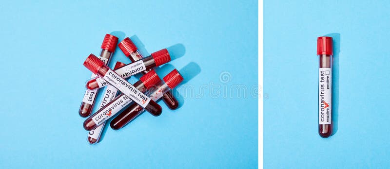 Collage of Test Tubes with Blood Samples and Coronavirus Test Lettering ...