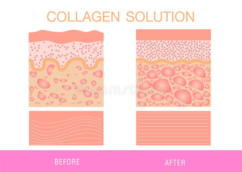 Collagen ,Protection Skin Vector Stock Vector - Illustration of female ...