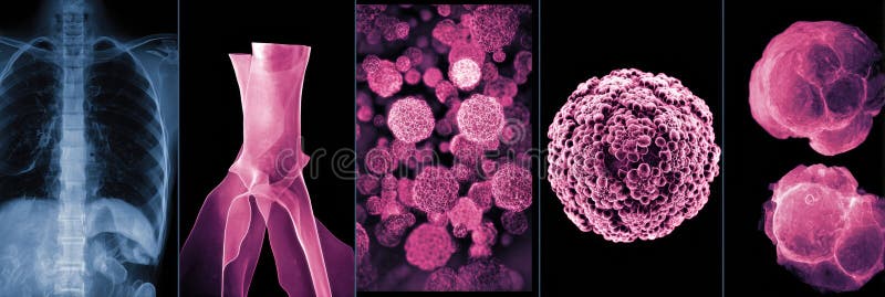 Visual Representation of Tumor Types and Associated Risk Factors in ...