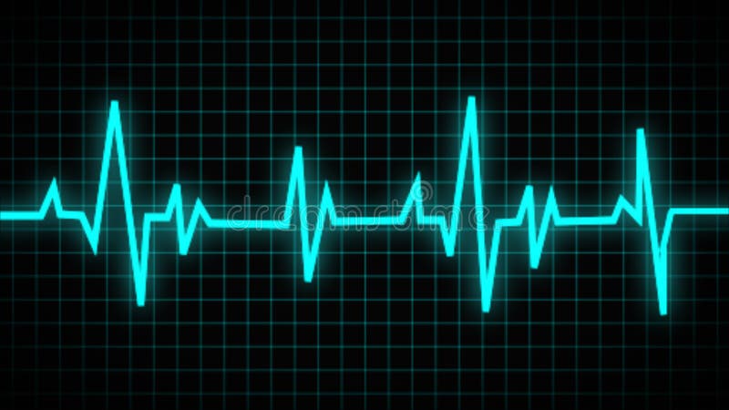 Collection of Normal and Abnormal ECGs. Vector of an Electrocardiogram ...