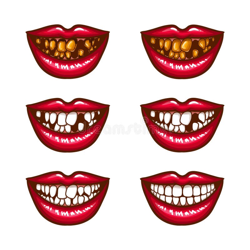 A Collection of Pop Art Icons of Red Female Lips - Smiling, with ...