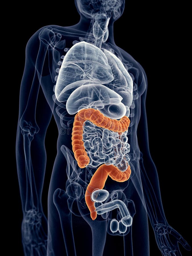 The colon stock illustration. Illustration of inflamed - 57000230