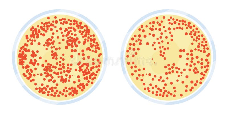 Colonies on Agar Gel Vector Illustration. Serratia Marcescens on an ...