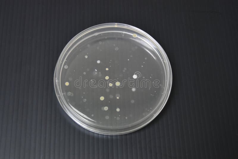 Colonies of Bacteria Growth on Agar Plate Stock Photo - Image of ...